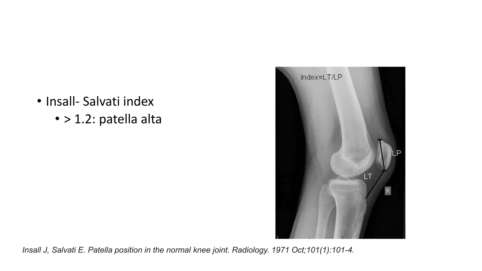 patellofemoral instability.pptx