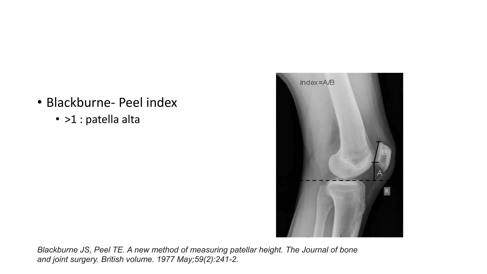 patellofemoral instability.pptx
