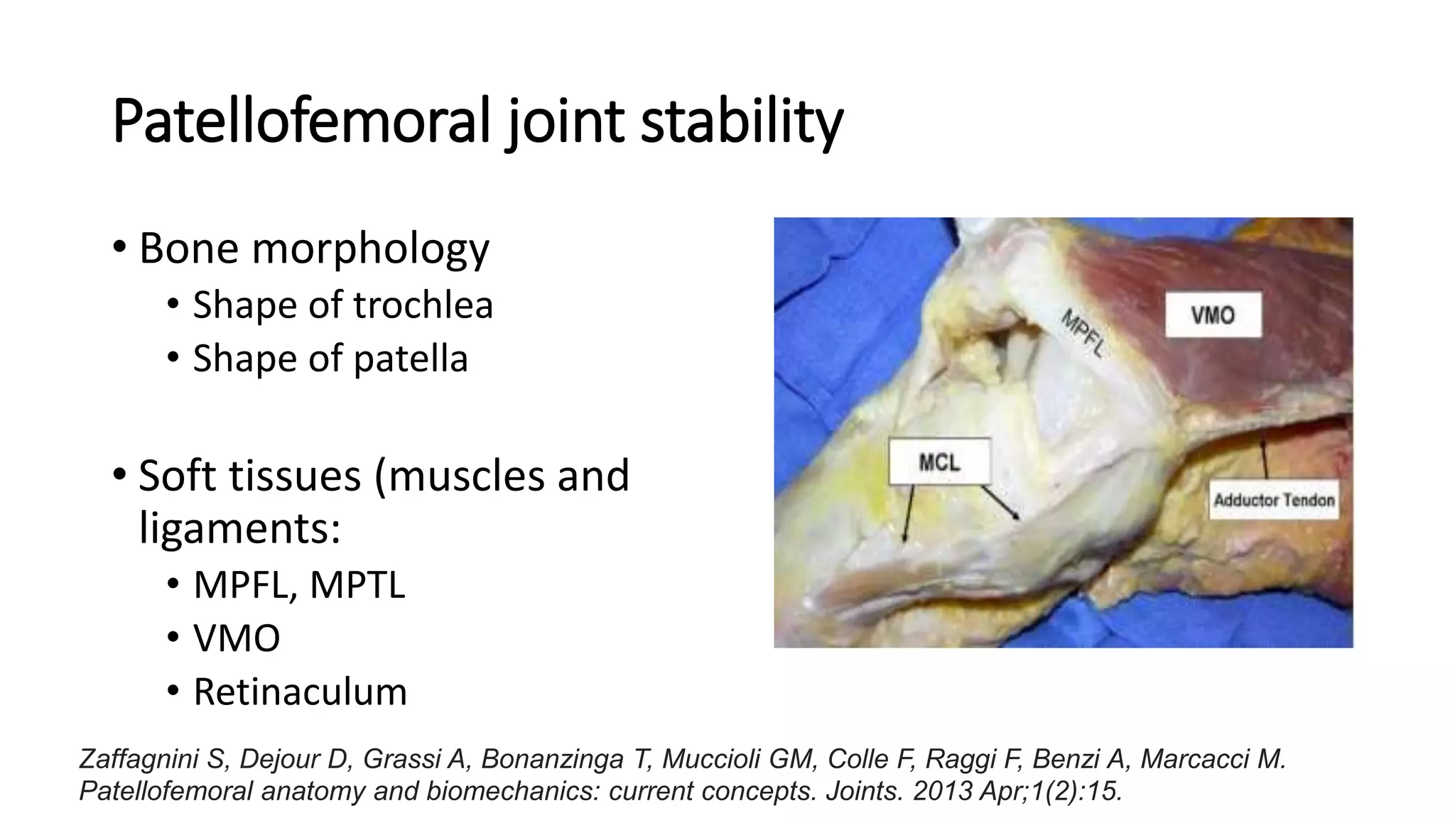 patellofemoral instability.pptx