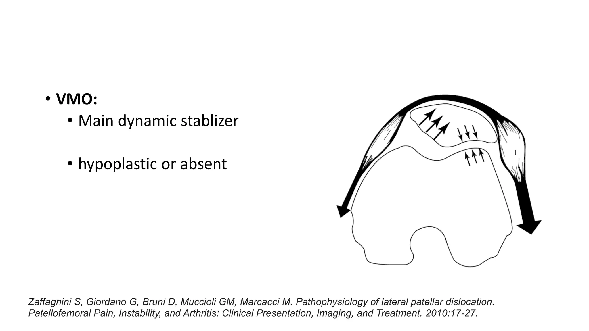 patellofemoral instability.pptx