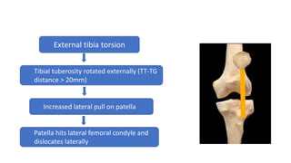 patellofemoral instability.pptx