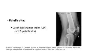 patellofemoral instability.pptx