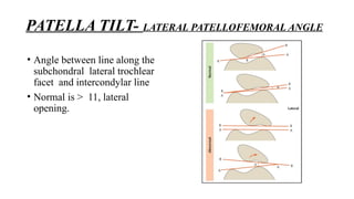 PATELLOFEMORAL INSTABILITY.pptx hvggfrrdr | PPTX