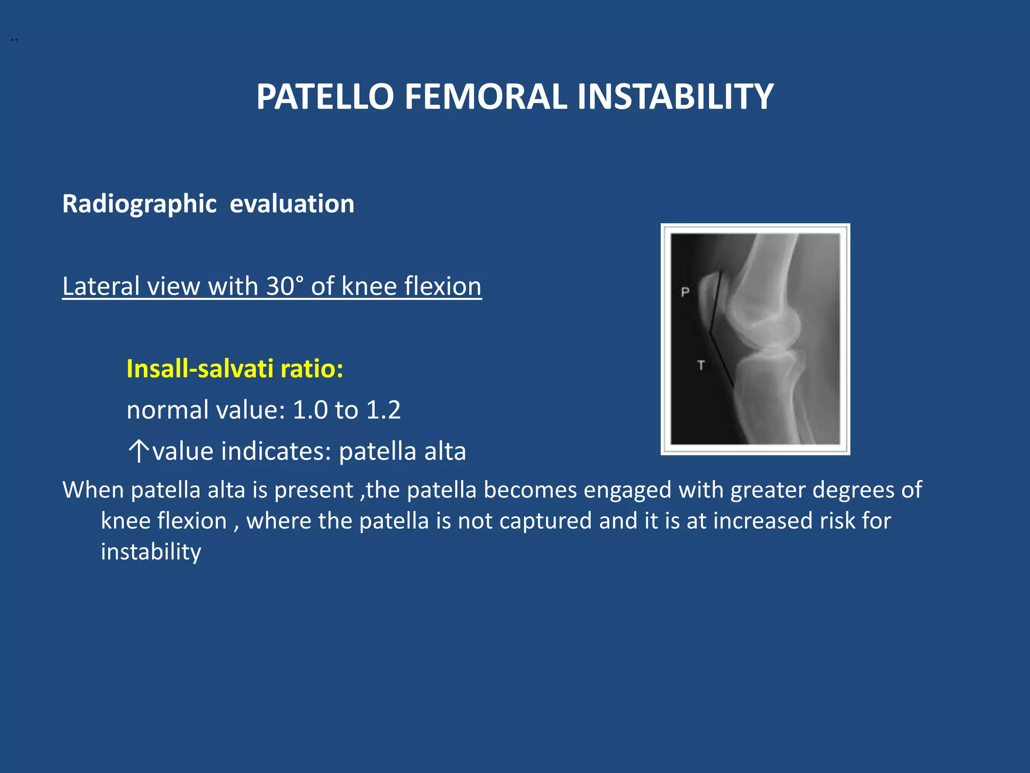 Patello femoral instability 22 | PPTX