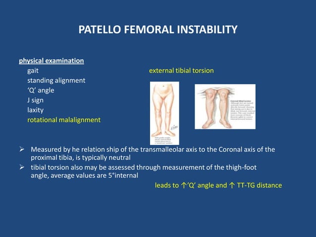 Patello femoral instability 22 | PPT