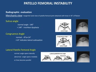 Patello femoral instability 22 | PPTX