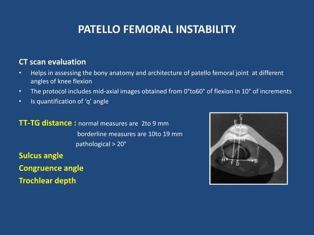 Patello femoral instability 22 | PPT