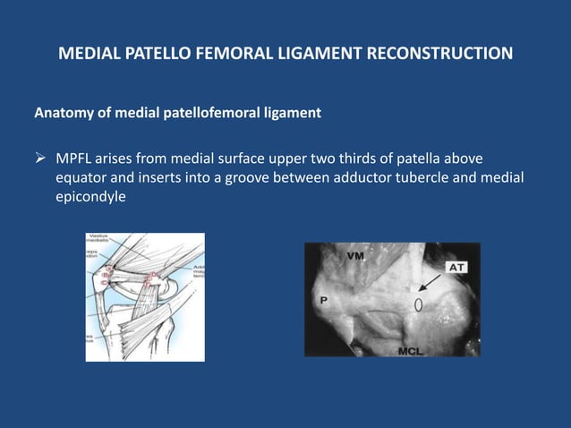 Patello femoral instability 22 | PPT