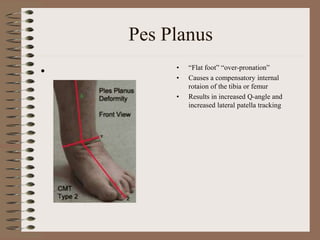 patellofemoral_pain_1.ppt