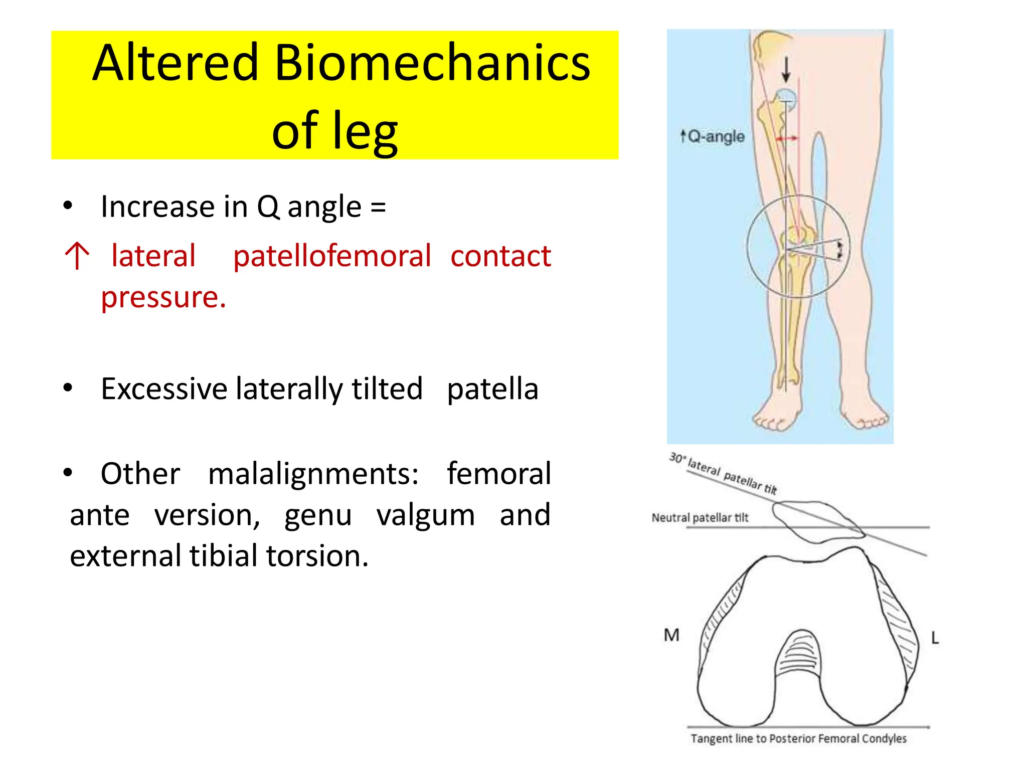 PATELLOFEMORAL PAIN (Harleen kaur Nagi).pptx