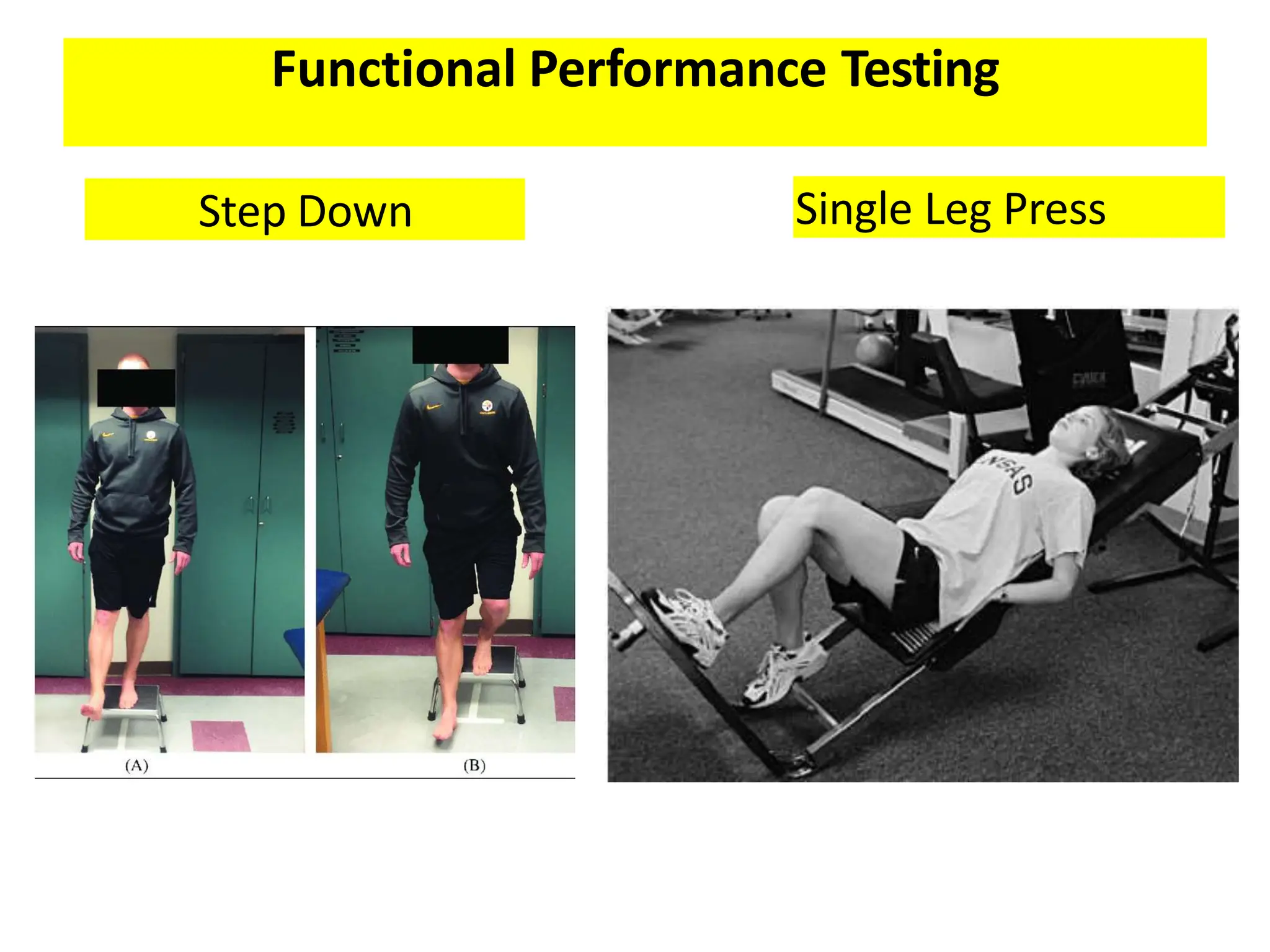 PATELLOFEMORAL PAIN (Harleen kaur Nagi).pptx