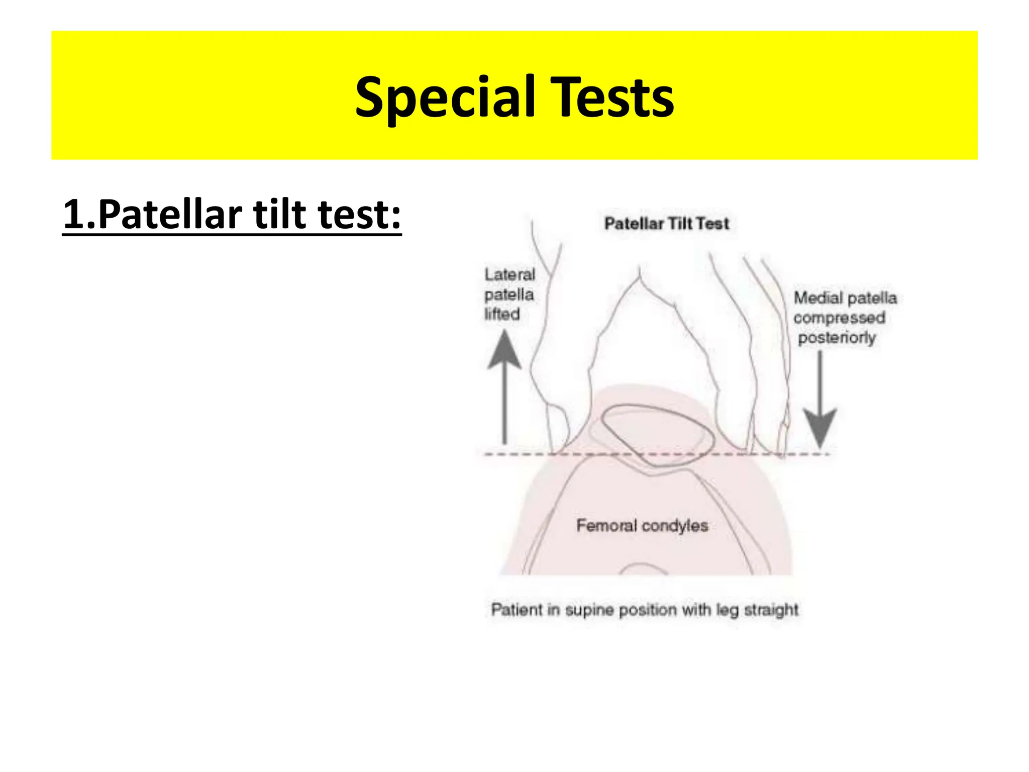 PATELLOFEMORAL PAIN (Harleen kaur Nagi).pptx