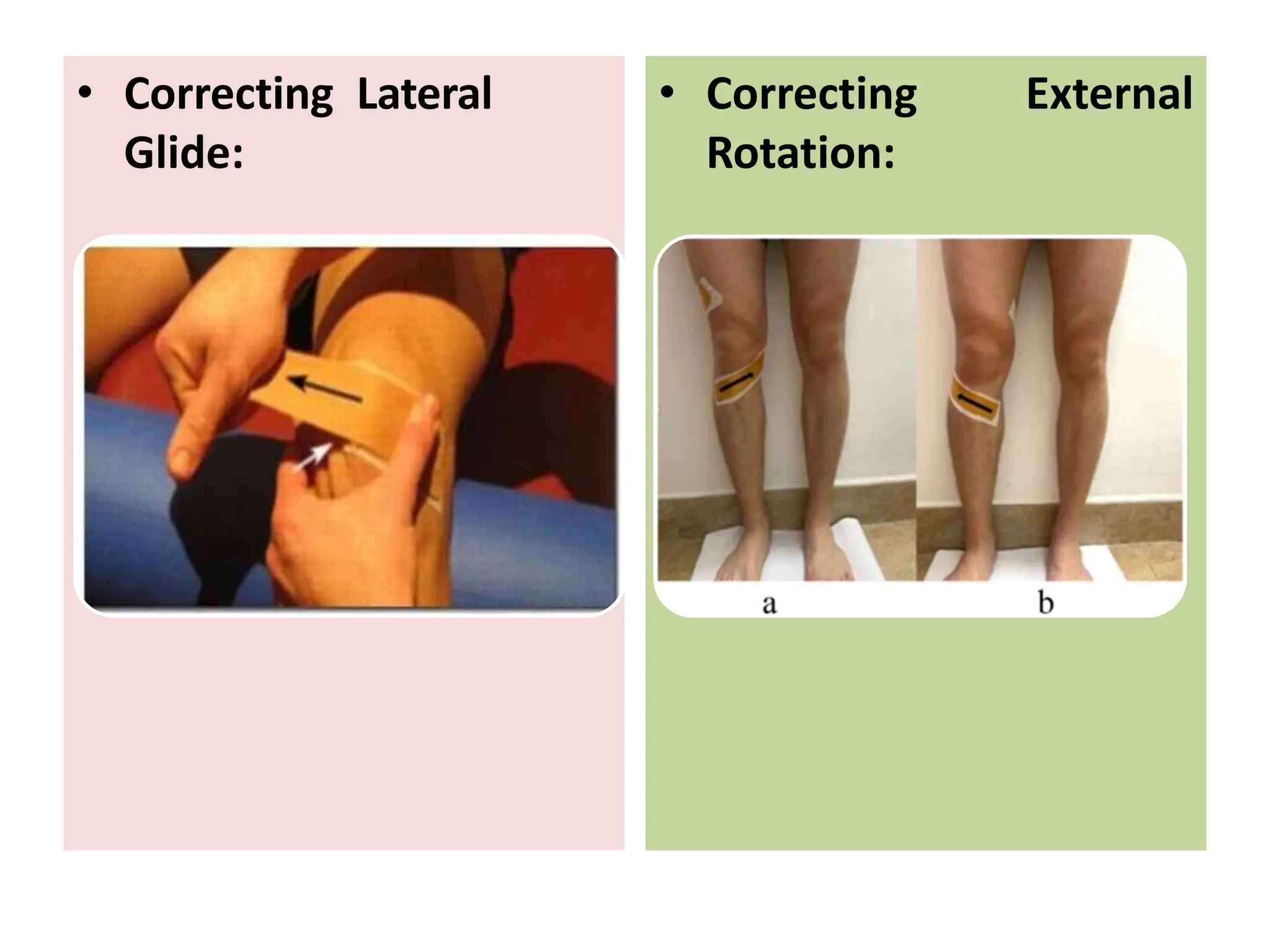 PATELLOFEMORAL PAIN (Harleen kaur Nagi).pptx