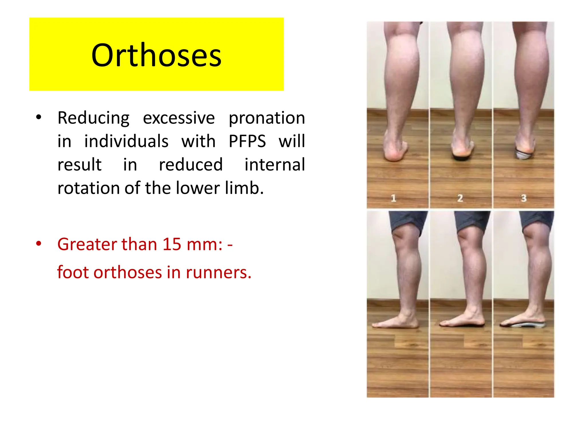 PATELLOFEMORAL PAIN (Harleen kaur Nagi).pptx