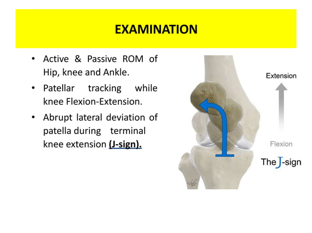 PATELLOFEMORAL PAIN (Harleen kaur Nagi).pptx