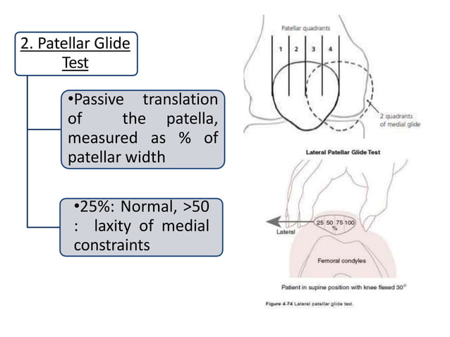 PATELLOFEMORAL PAIN (Harleen kaur Nagi).pptx