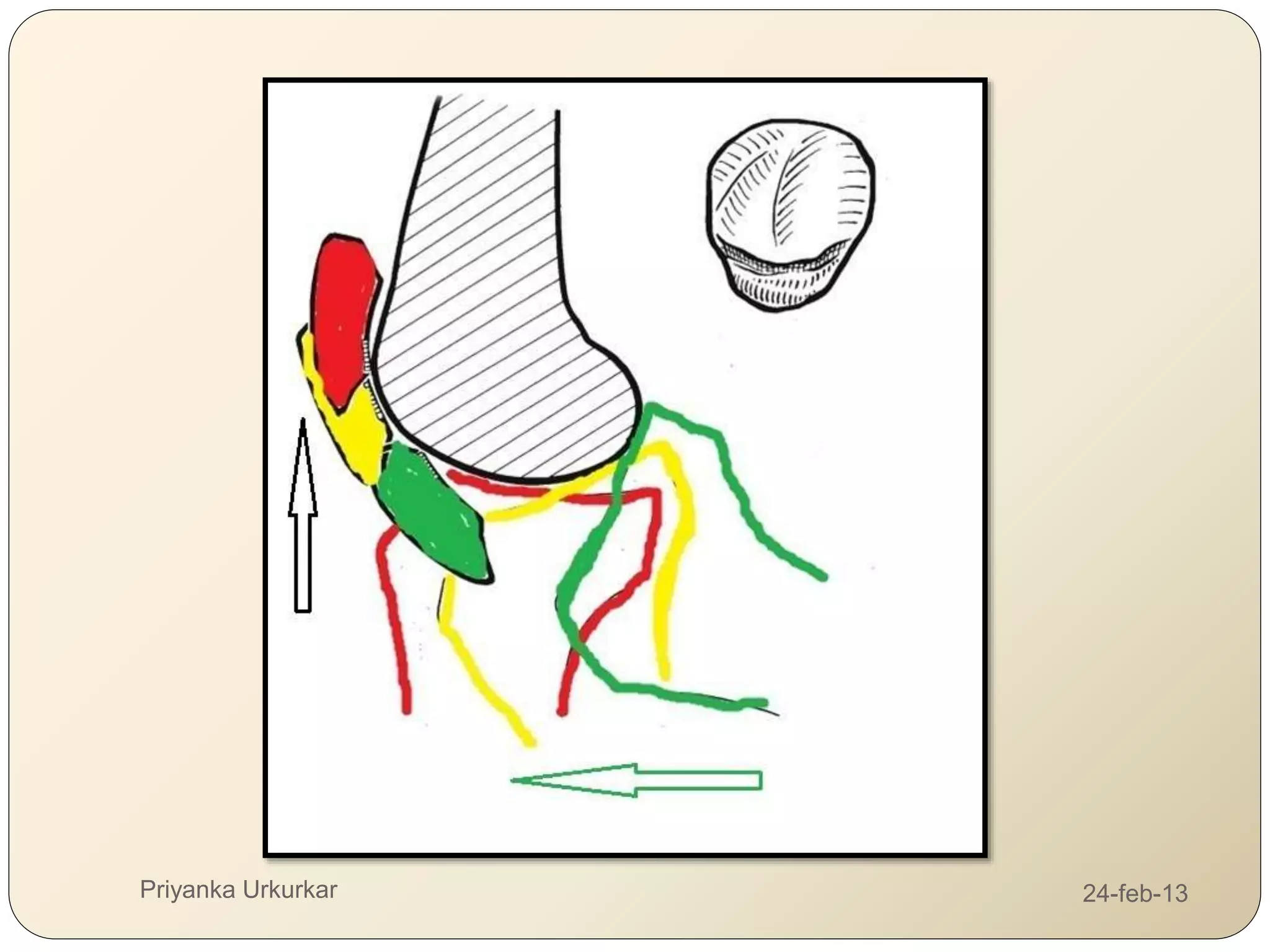 Patellofemoral pain syndrome (pfps) | PPTX