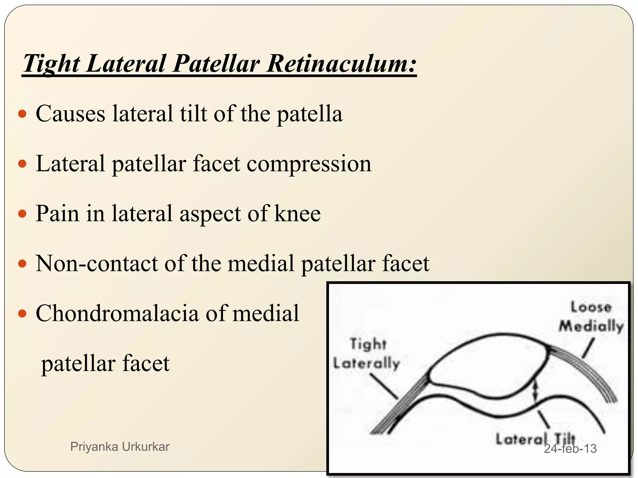Patellofemoral pain syndrome (pfps) | PPTX