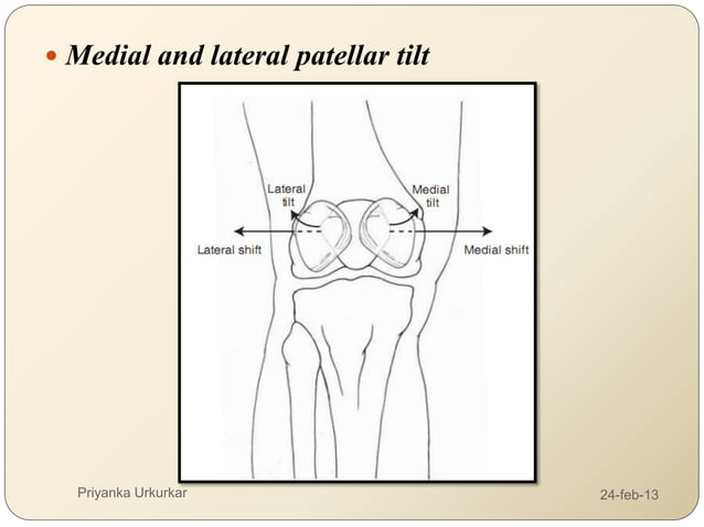 Patellofemoral pain syndrome (pfps) | PPTX | Death, Injury, or Military ...