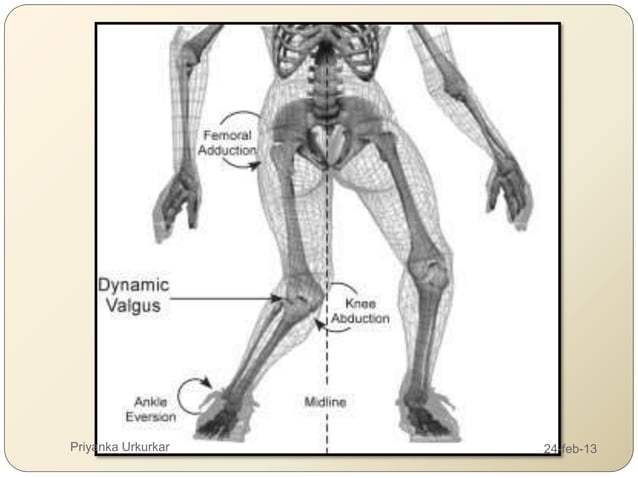 Patellofemoral pain syndrome (pfps) | PPTX | Death, Injury, or Military ...