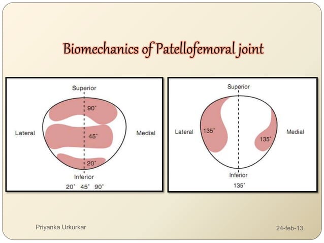 Patellofemoral pain syndrome (pfps) | PPTX | Death, Injury, or Military ...