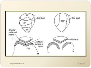 Patellofemoral pain syndrome (pfps) | PPT