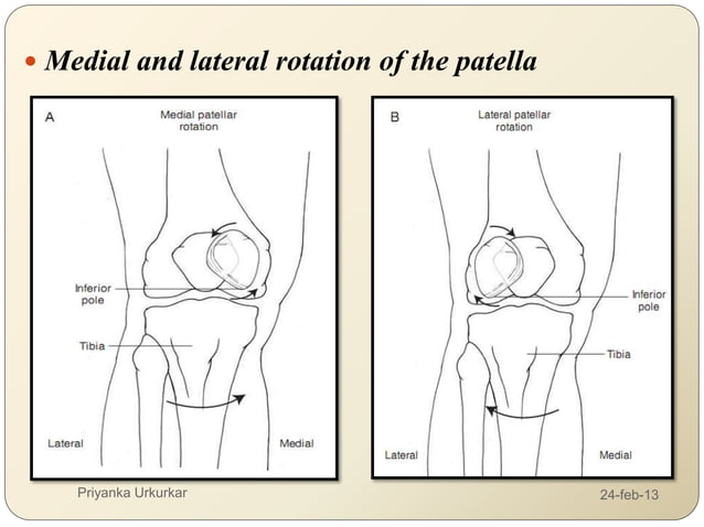 Patellofemoral pain syndrome (pfps)