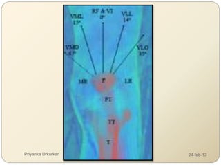 Patellofemoral pain syndrome (pfps) | PPT
