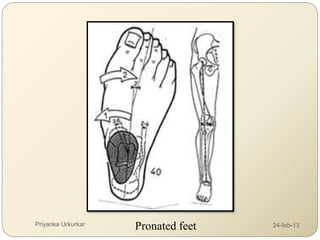 Patellofemoral pain syndrome (pfps) | PPT