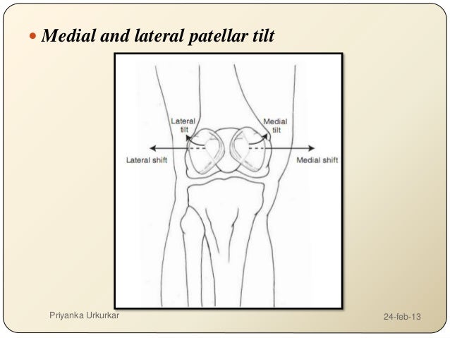 Patellofemoral pain syndrome (pfps)