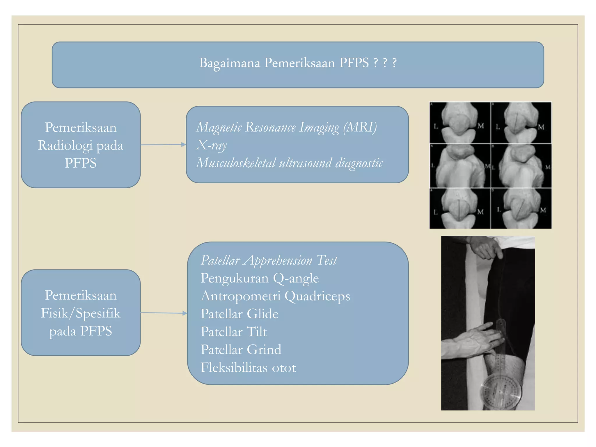 Patellofemoral pain syndrome (pfps) | PPT