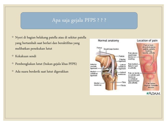 Patellofemoral pain syndrome (pfps) | PPTX