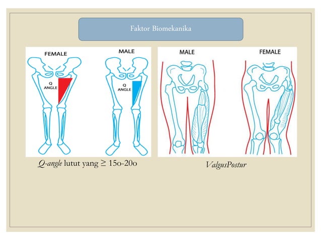 Patellofemoral pain syndrome (pfps) | PPTX