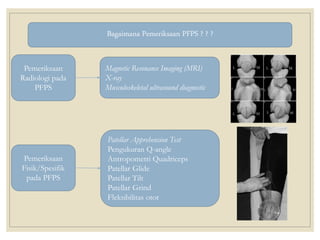 Patellofemoral pain syndrome (pfps) | PPTX