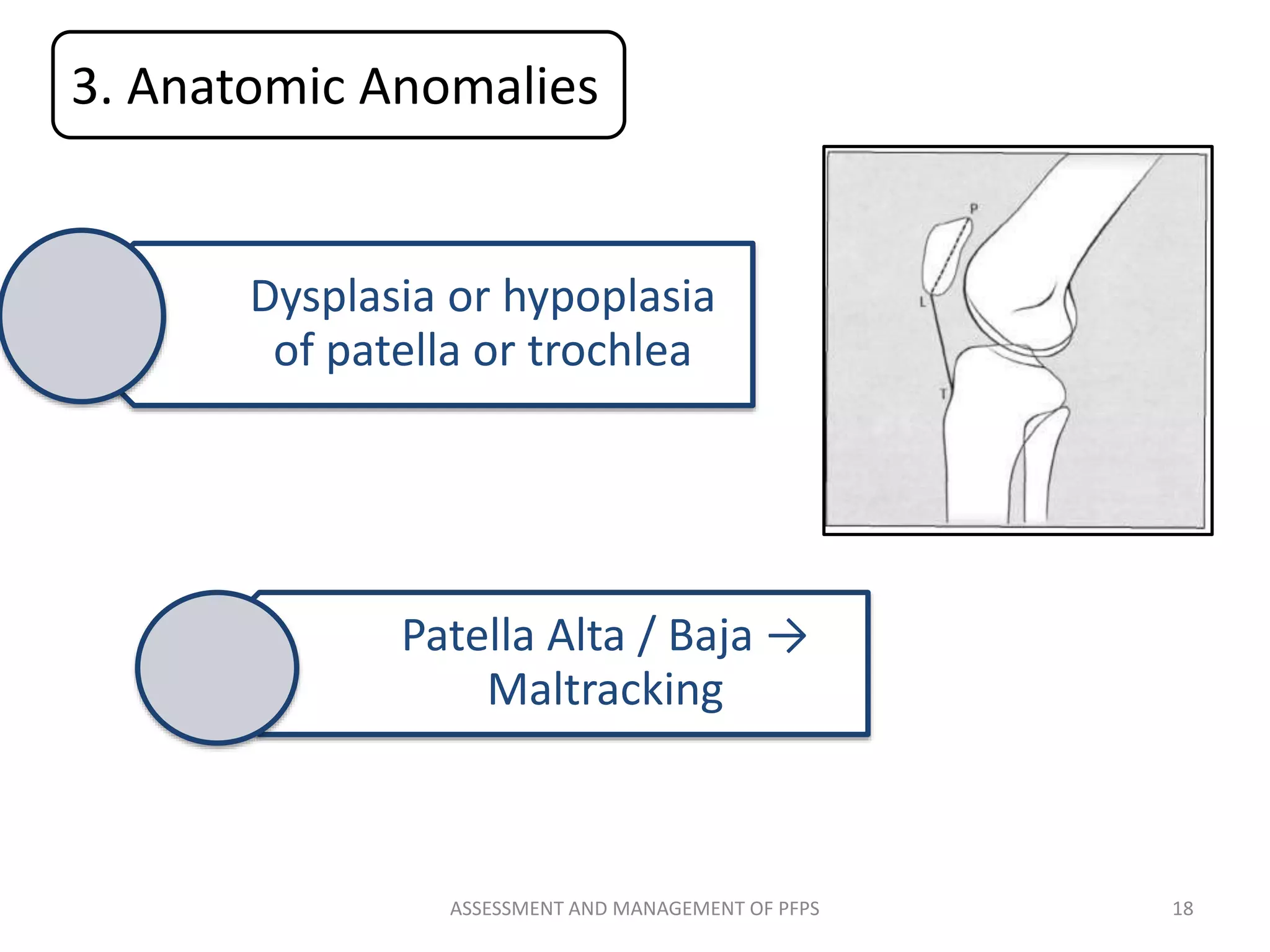 Patellofemoral pain syndrome (pfps) | PPTX