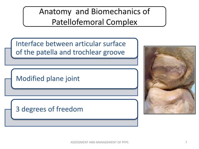 Patellofemoral pain syndrome (pfps) | PPTX | Death, Injury, or Military ...