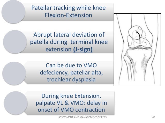 patellar tracking test