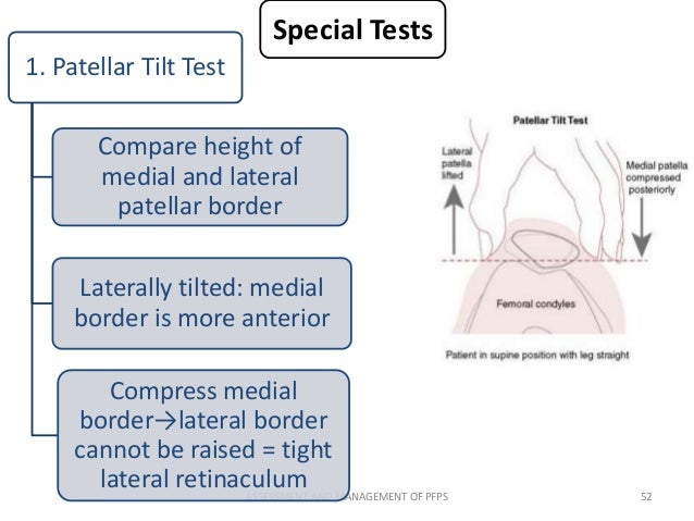 Patellofemoral pain syndrome (pfps)