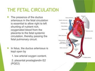 PATENT DUCTUS ARTERIOSUS- clinical features and pathophysiology | PPTX