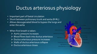 Patent ductus arteriosus | PPTX | Heart and Cardiovascular Diseases ...