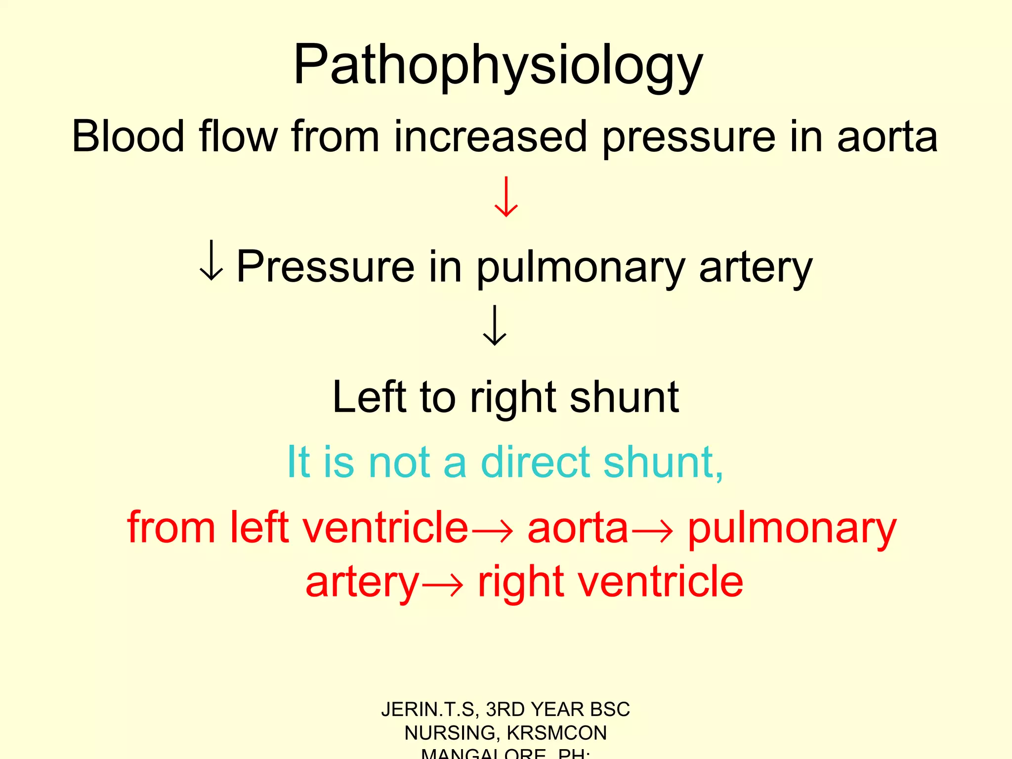 Patent ductus arteriosus | PPT