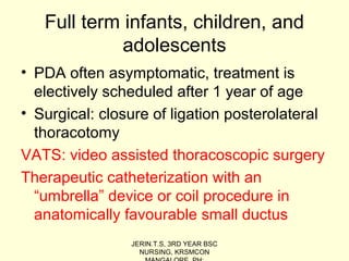 Patent ductus arteriosus | PPT