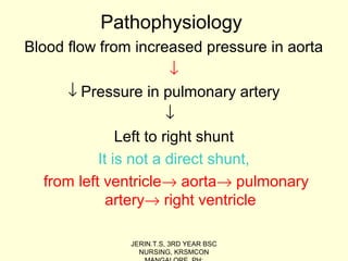 Patent ductus arteriosus | PPT