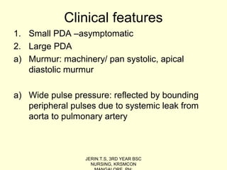 Patent ductus arteriosus | PPT