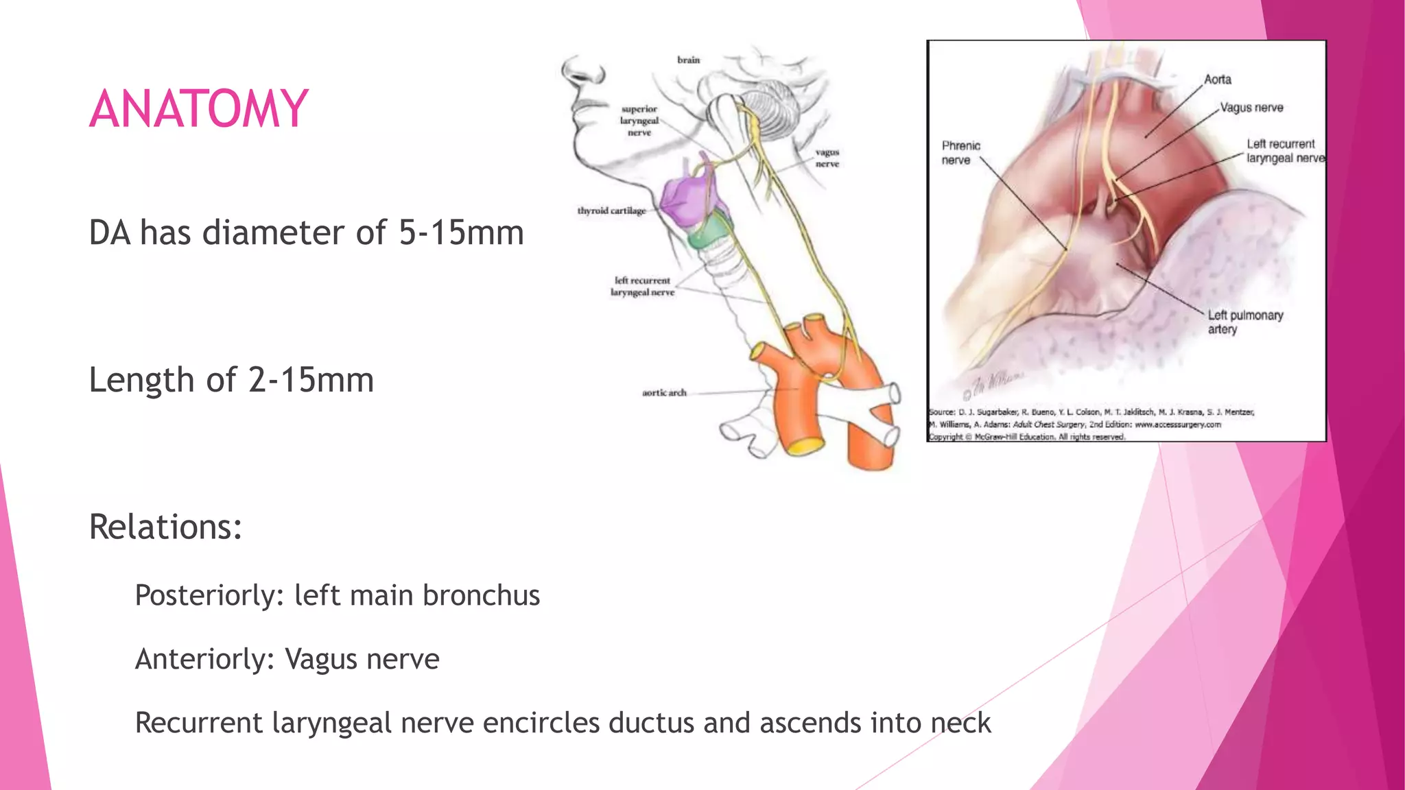 Patent ductus arteriosus | PPTX