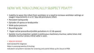 PATENT DUCTUS ARTERIOSUS.pptx
