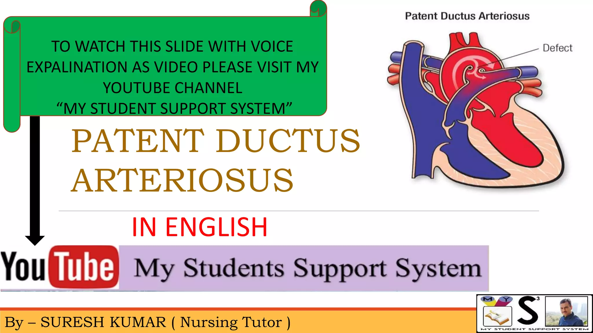 Patent ductus arteriosus in english | PPTX