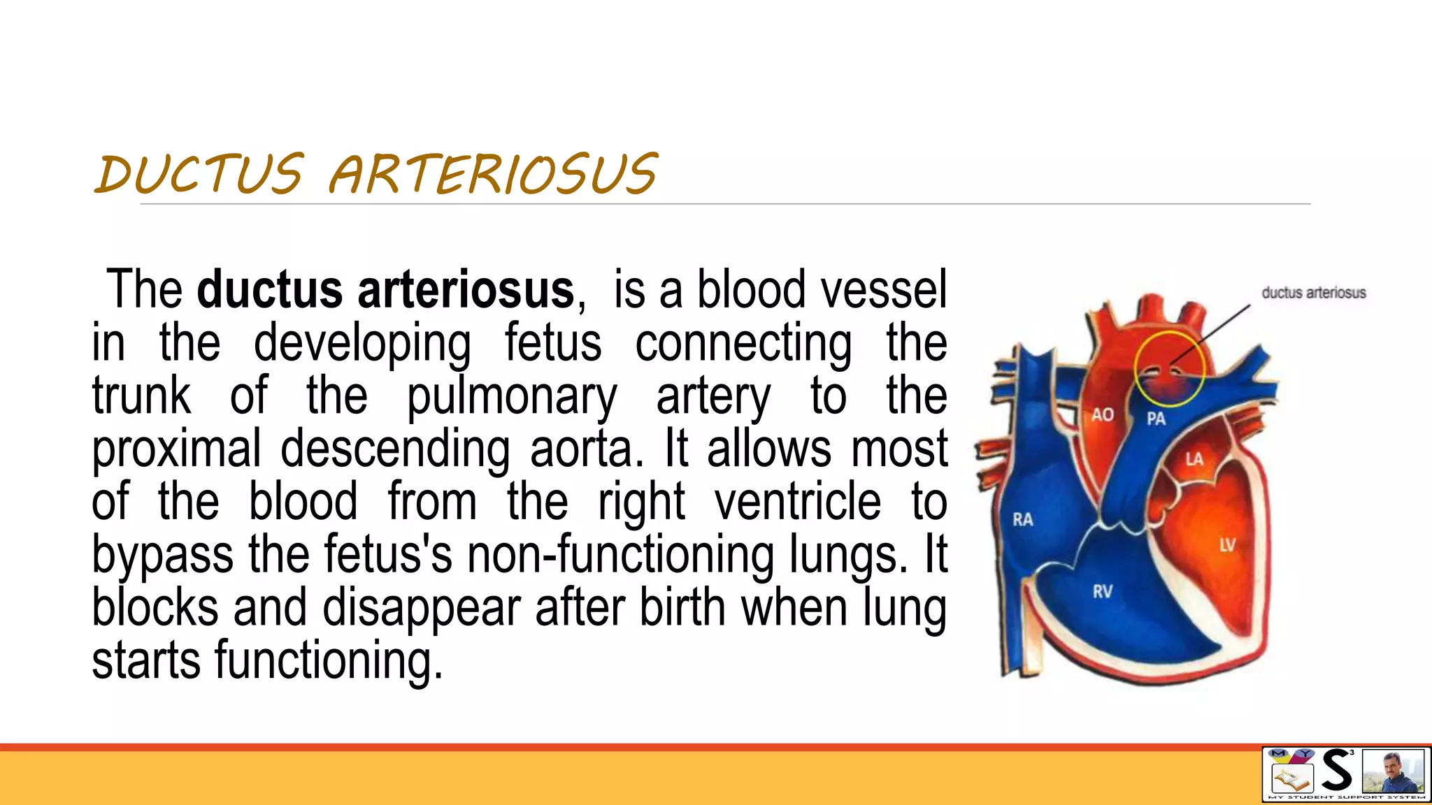 Patent ductus arteriosus in english | PPTX