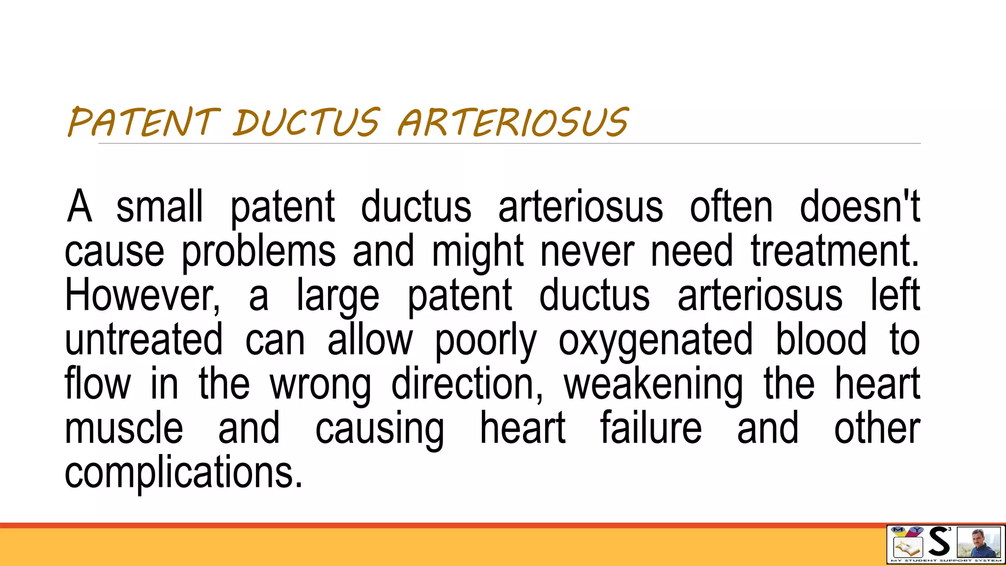 Patent ductus arteriosus in english | PPTX