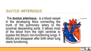 Patent ductus arteriosus in english | PPTX